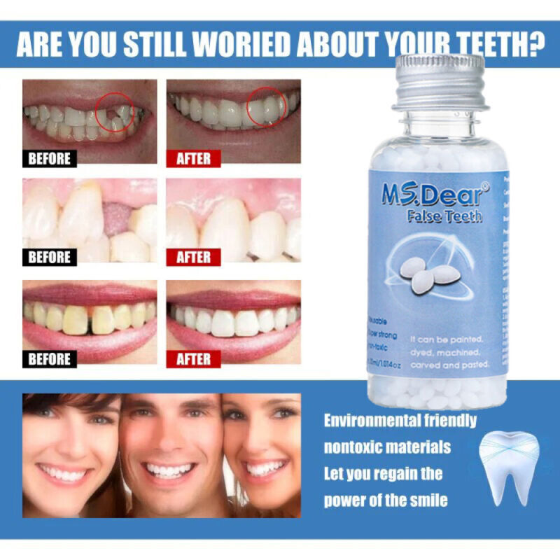 2X Temporary Tooth Repair Kit Teeth Gaps False Teeth Solid Glue Denture ...