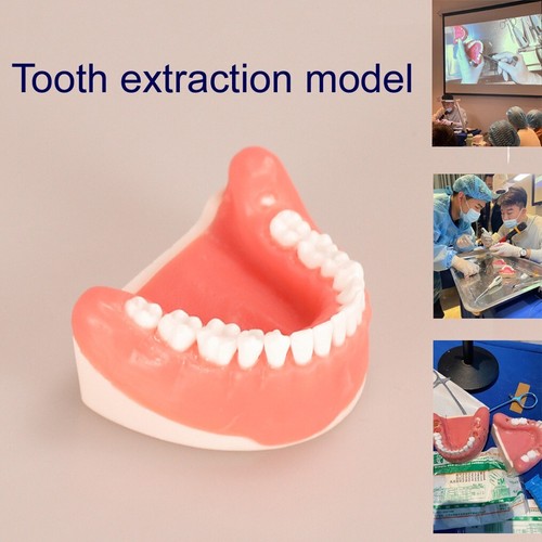 Maxillary+Mandibular Tooth Extraction Practice Model Dental Typodont ...