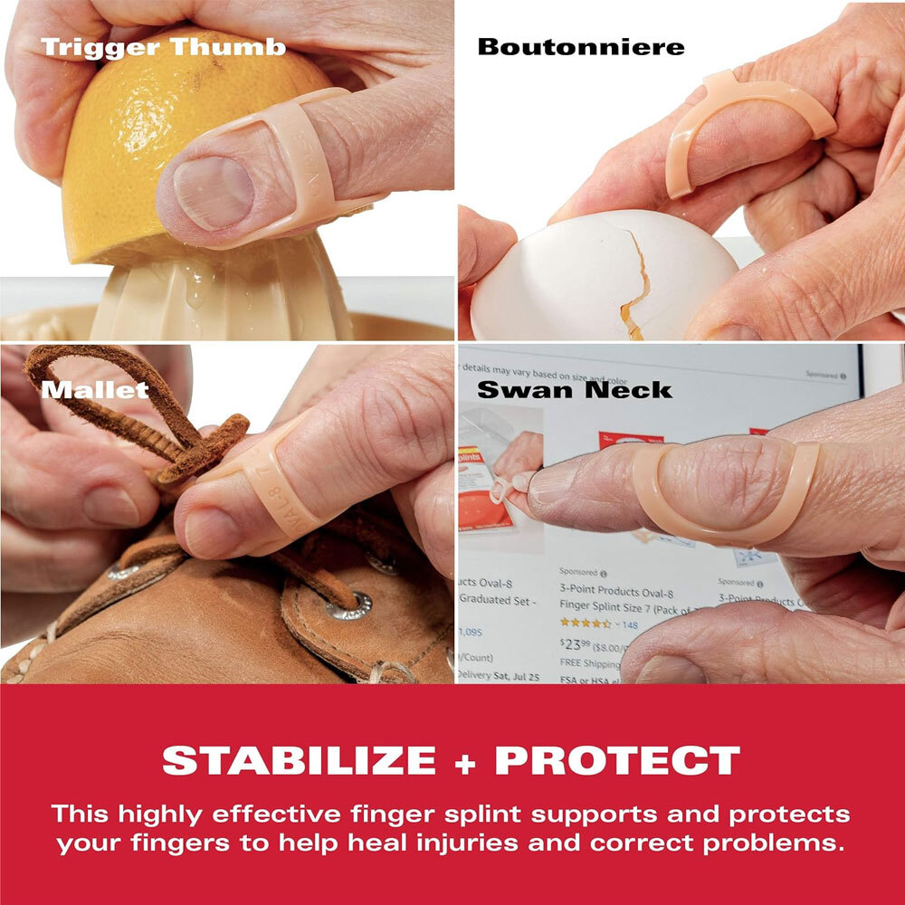 Oval 8 Thumb Splint Printable Oval 8 Sizing Guide Oval 8 Finger Splint ...