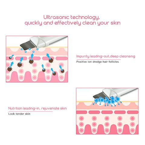 Skin Scrubber Face Cleanser Blackhead Acne Removal Facial Spa Vibration ...