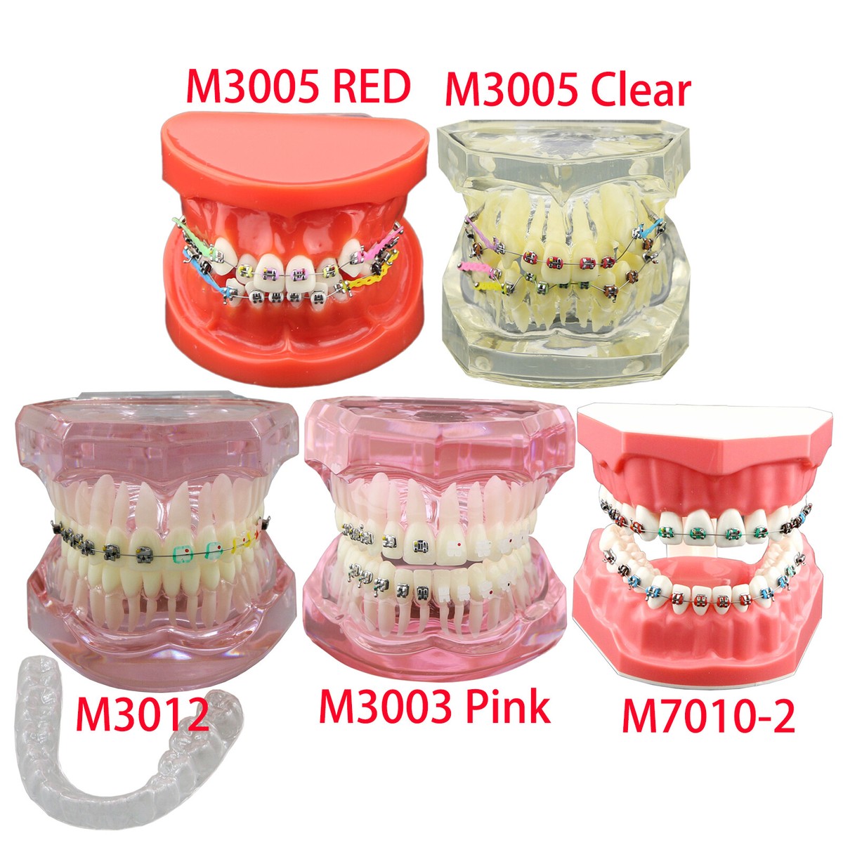 Light Pink Braces For Teeth Braces Colours – Everything You Need To