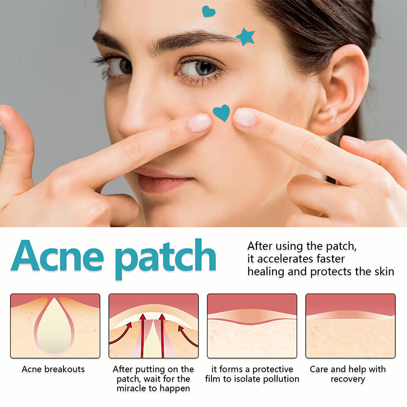 216Pcs Acne Pimple Patch Cute Shape Absorb Fluid Acne Stickers Spot ...