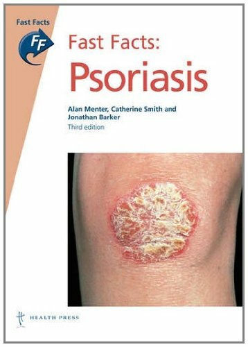 Systemic Fungal Infections (Fast Facts) By Alan Menter 9781903734032| eBay