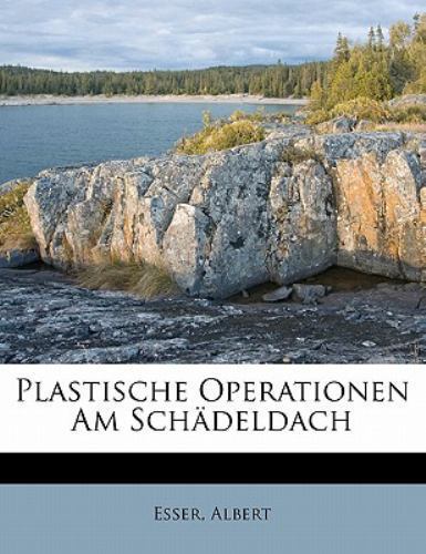 Plastische Operationen Am Sch?deldach by Esser Albert (2010, Trade ...