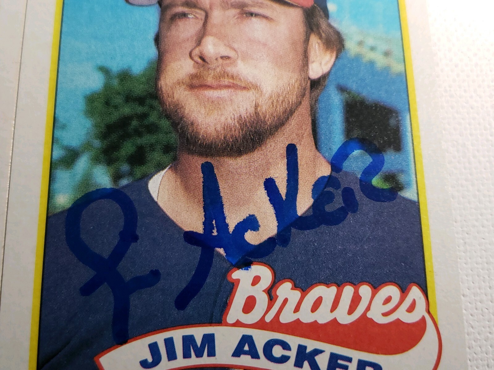 Topps Jim Acker Auto Lot Autograph Signed Cards Braves Blue Jays 1987 ...