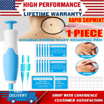 Auto Micro Skin Tag Remover Device Kit Safe Painless Removal 2-8 mm ...