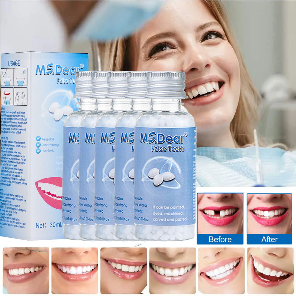 Resin False Teeth Solid Glue Temporary Tooth Repair Moldable Teeth Gap ...