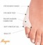 Tailor Bunion Relief Soft Silicone Bunionette Corrector Splint Gel ...