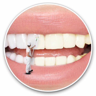 2 x Vinyl Stickers 7.5cm - Dental Teeth Whitening Dentist Cool Gift ...