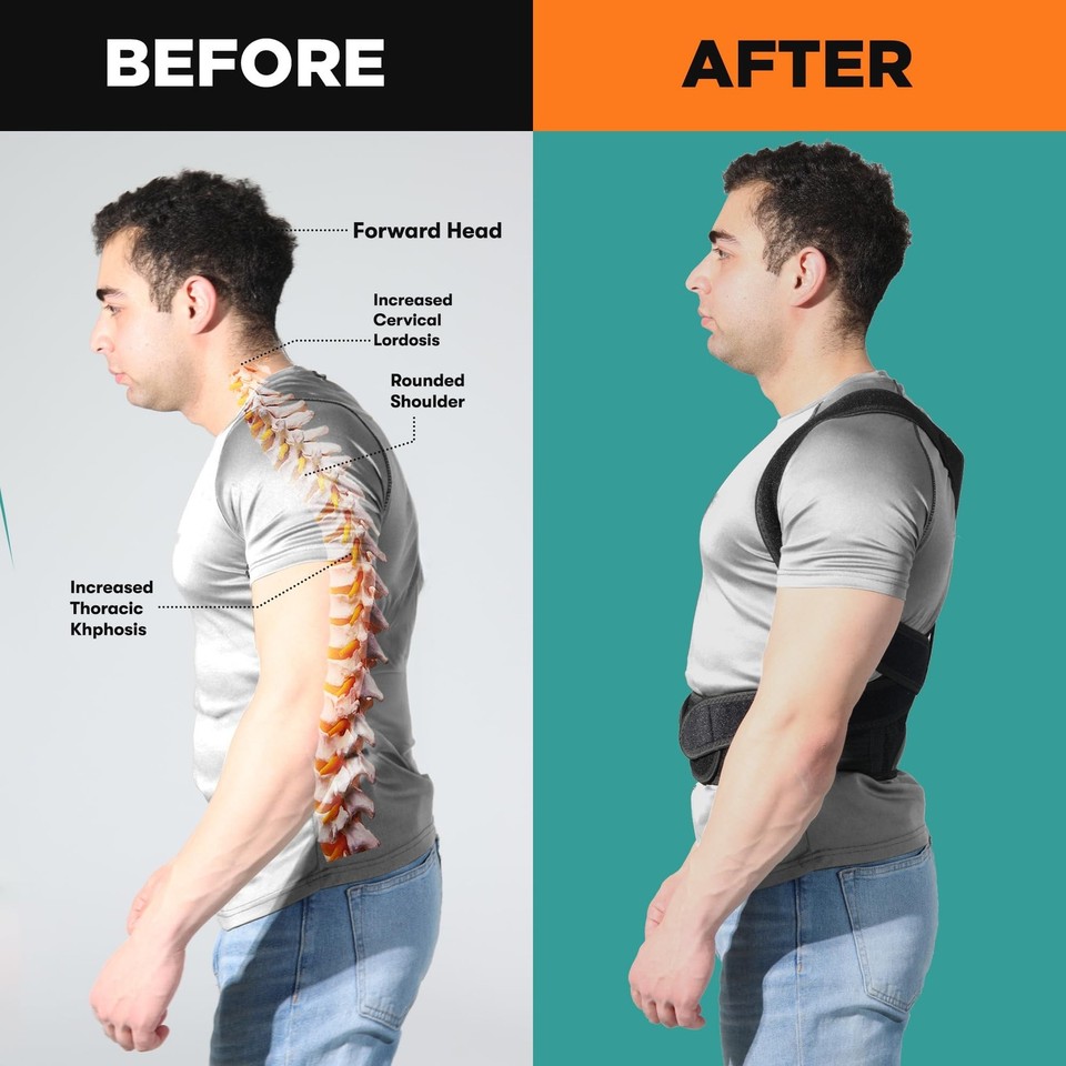 Posture Corrector for Men, Adjustable Mens Posture Corrector, Back ...