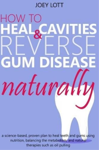 Joey Lott How to Heal Cavities and Reverse Gum Disease N (Paperback ...
