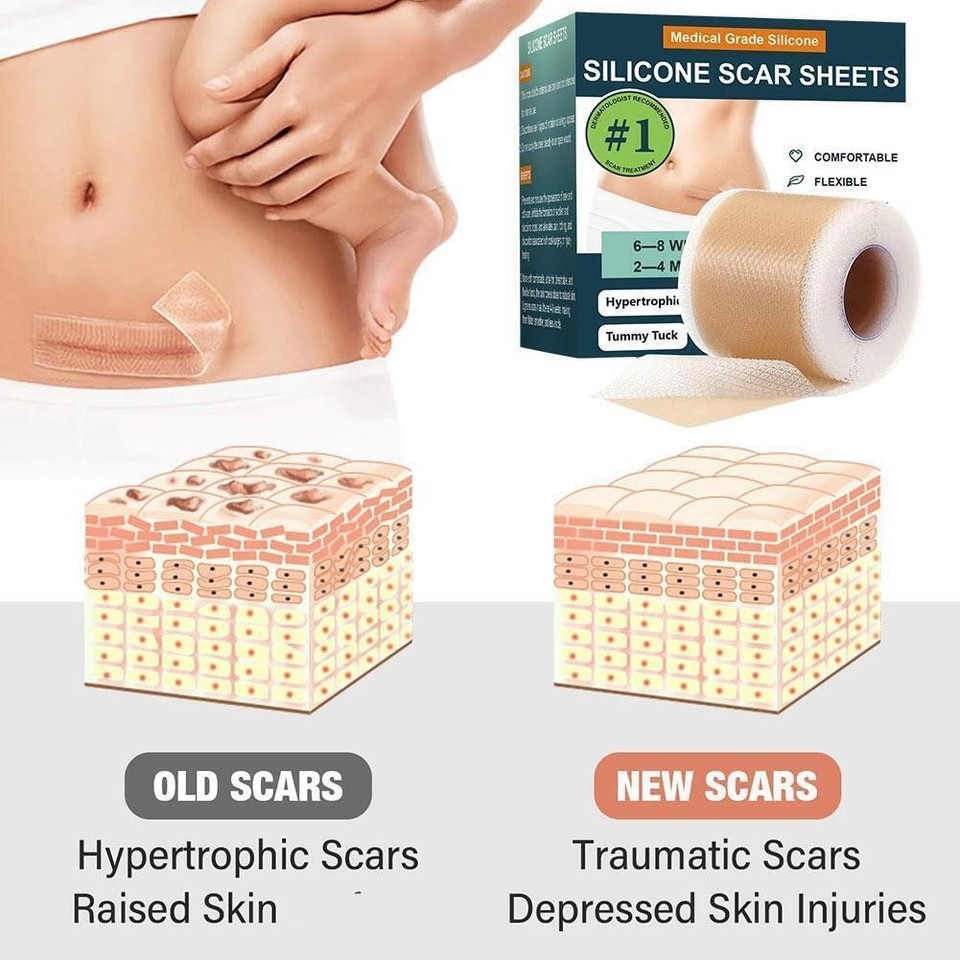 Silicone Scar Sheets,Sil icone Scar Tape,Silicone She P2DJD76 For Scars ...