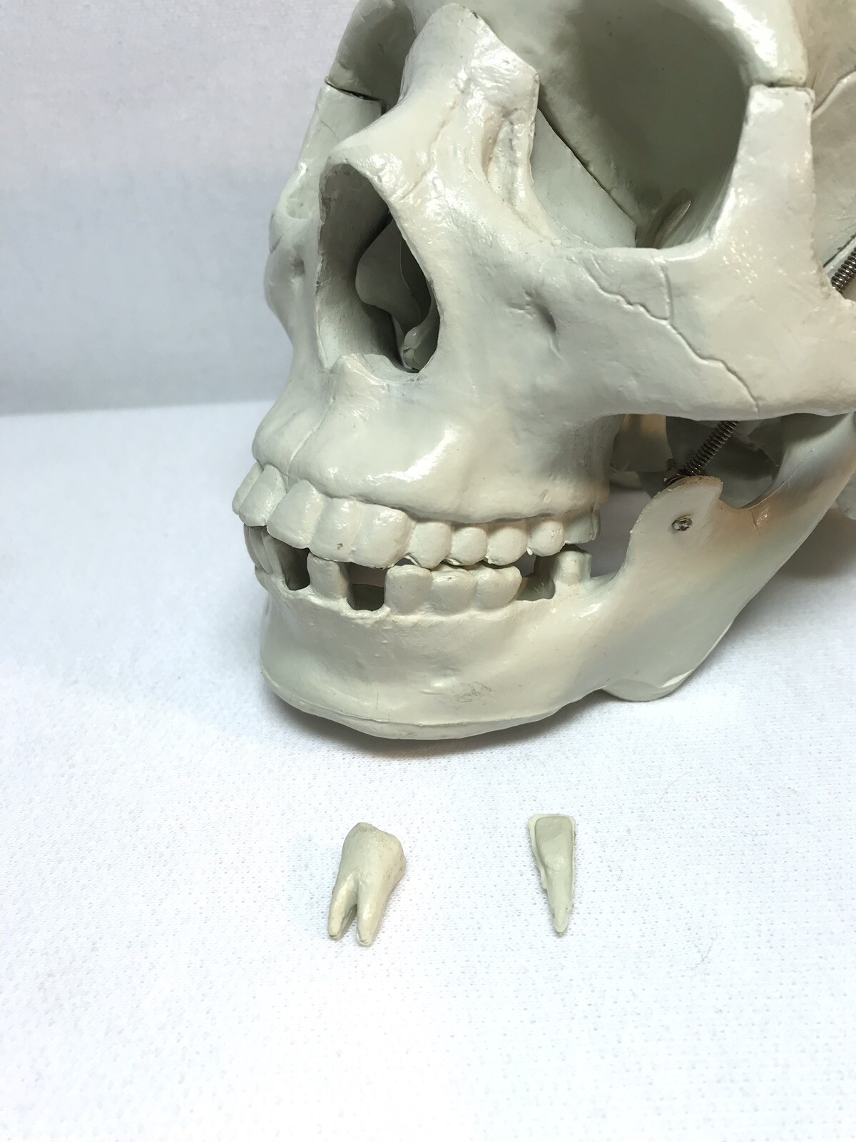 Anatomical Skull Model Educational Life Size Removeable Teeth Hinge Jaw ...