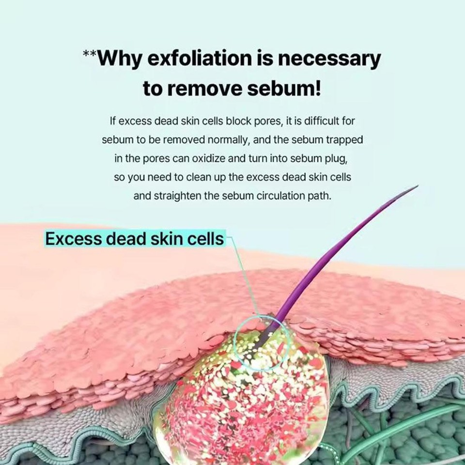 ILSO Super Melting SEBUM Softener MINIMIZE SEBUM Blackhead Extractor ...