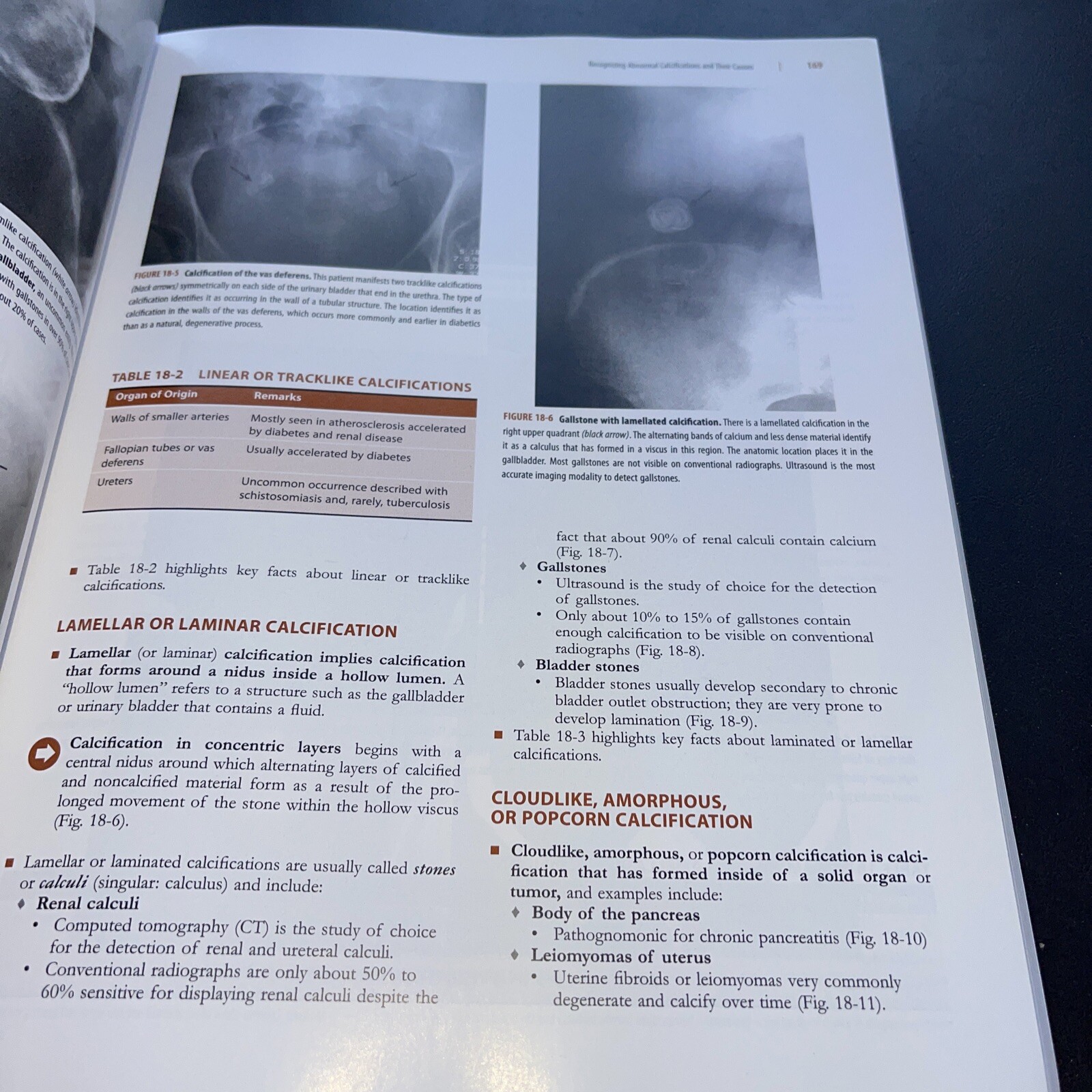 Learning Radiology: Recognizing the Basics , paperback , Herring MD ...