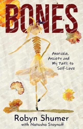 Robyn Shumer Natasha Stoynoff Bones (Paperback) (UK IMPORT ...