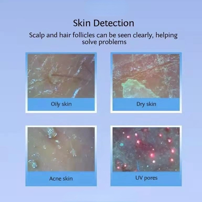 11'' Professional Hair Follicles Scalp Camera Digital Skin Microscope ...