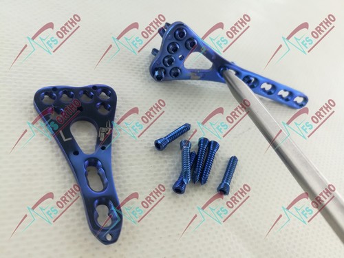 Variable Angle DVR Radius Volar LCP plate 2 to 5 L & R & Screw Set of ...