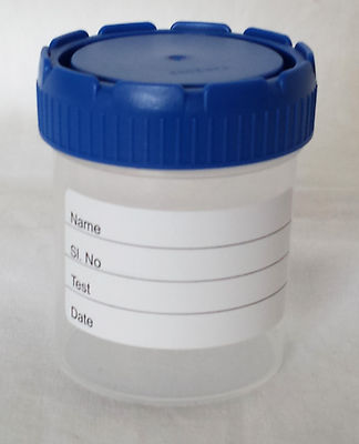 Labelled URINE SPECIMEN CONTAINERS STERILISED SAMPLE BOTTLES 100ml ...