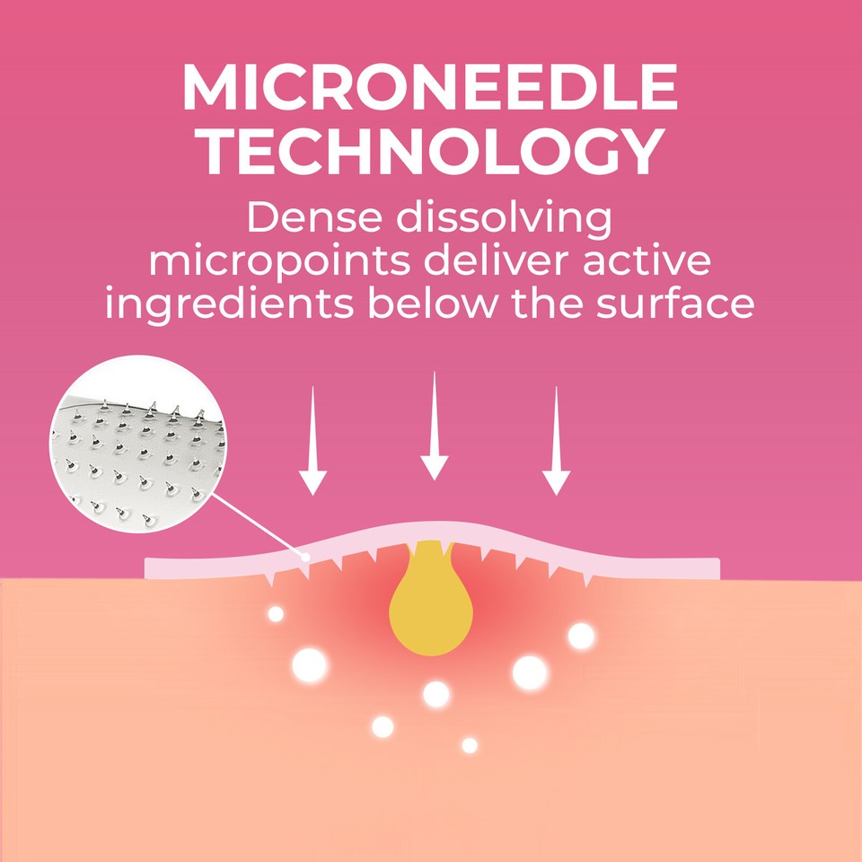 Microdart Pimple Patches for Face Acne Patches with Hydrocolloid All ...