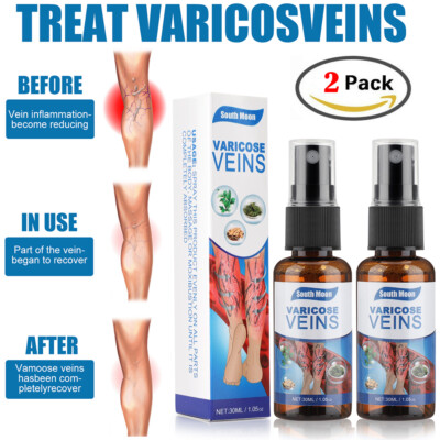 2Pcs VeinFix Varicose Treatment Spray Veinhealing Varicose Veins Treatment Spray | eBay