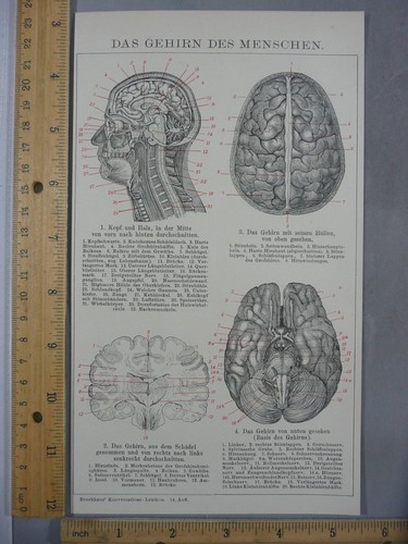 Rare Original VTG Human Brain Dissection Chart Illustration Art Print ...