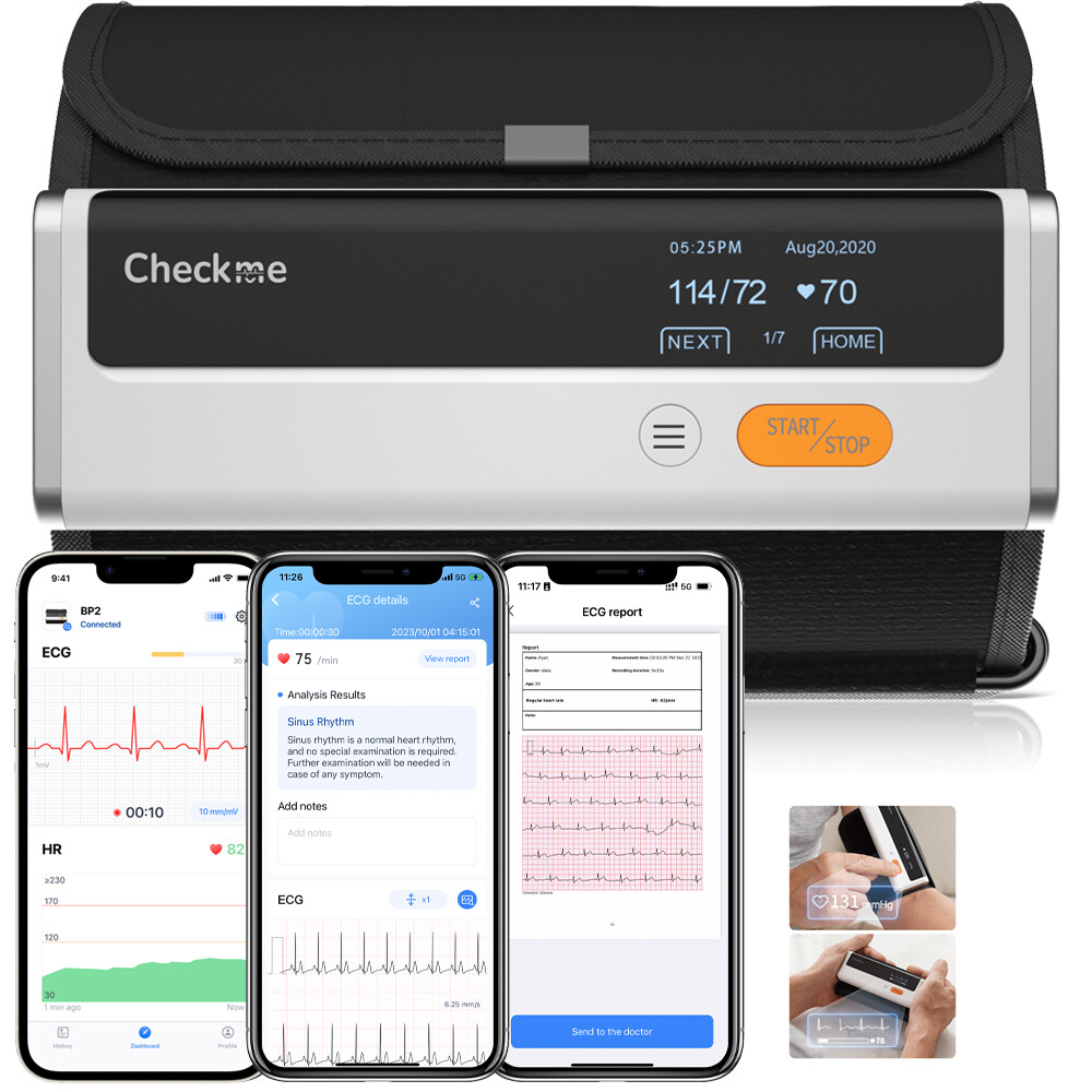 Wellue EKG Monitor with Blood Pressure Monitor APP AI-ECG Analysis ...