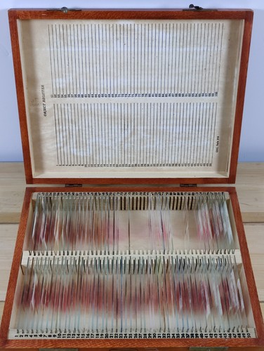 Vintage Microscope Possibly Pathology Medical Lab Slides with Wooden ...