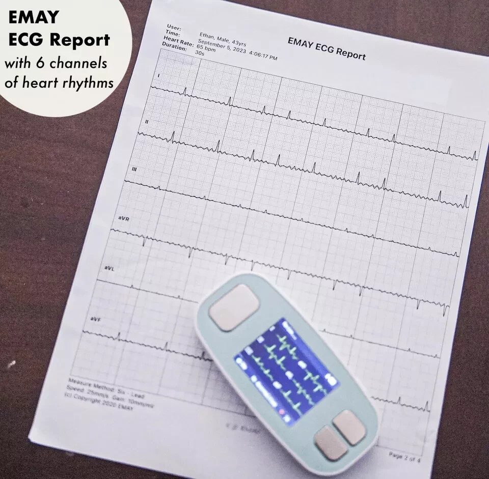 EMAY 6Leads Portable ECG Monitor Record ECG and Heart Rate in 6 ...