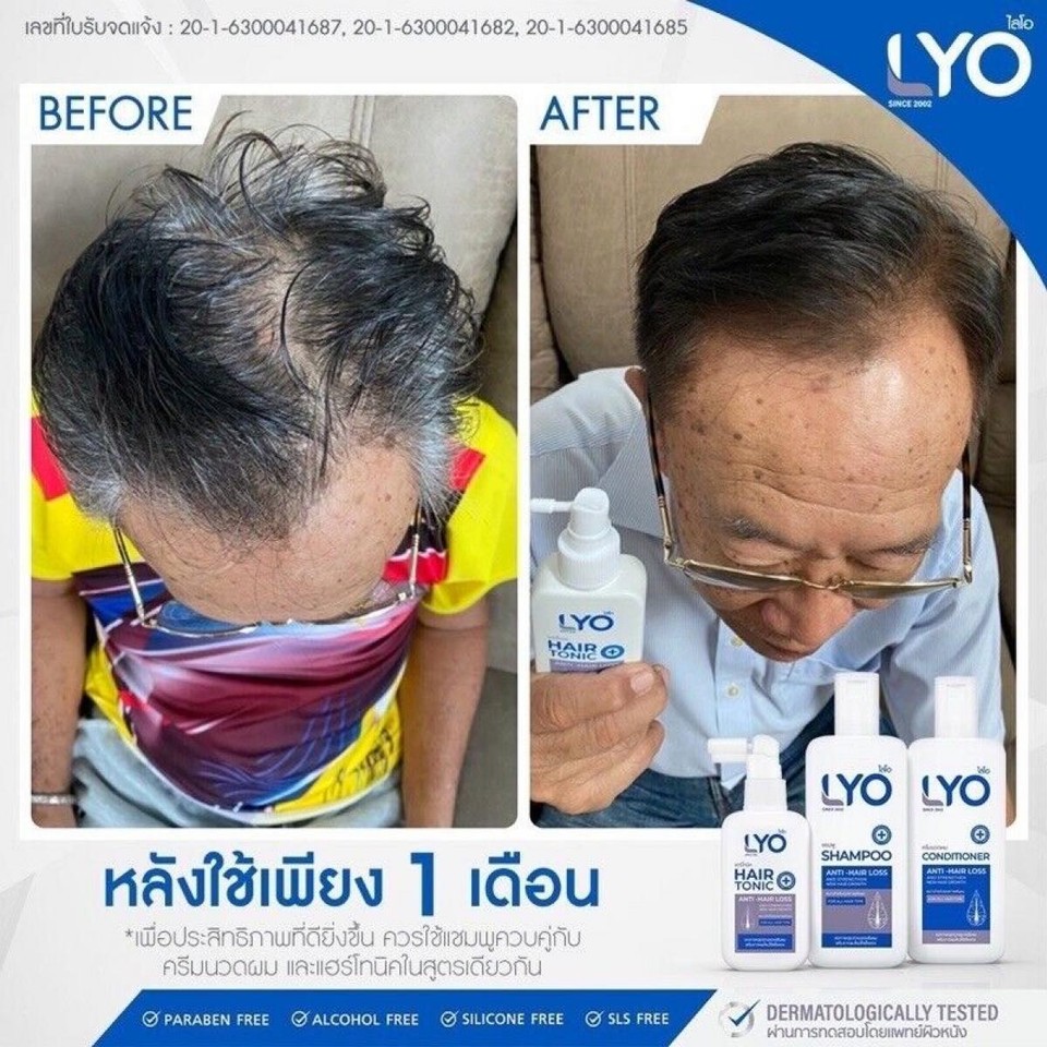 3X LYO Hair Tonic Herbal Extracts Anti Hair loss Growth Hair [ Free ...