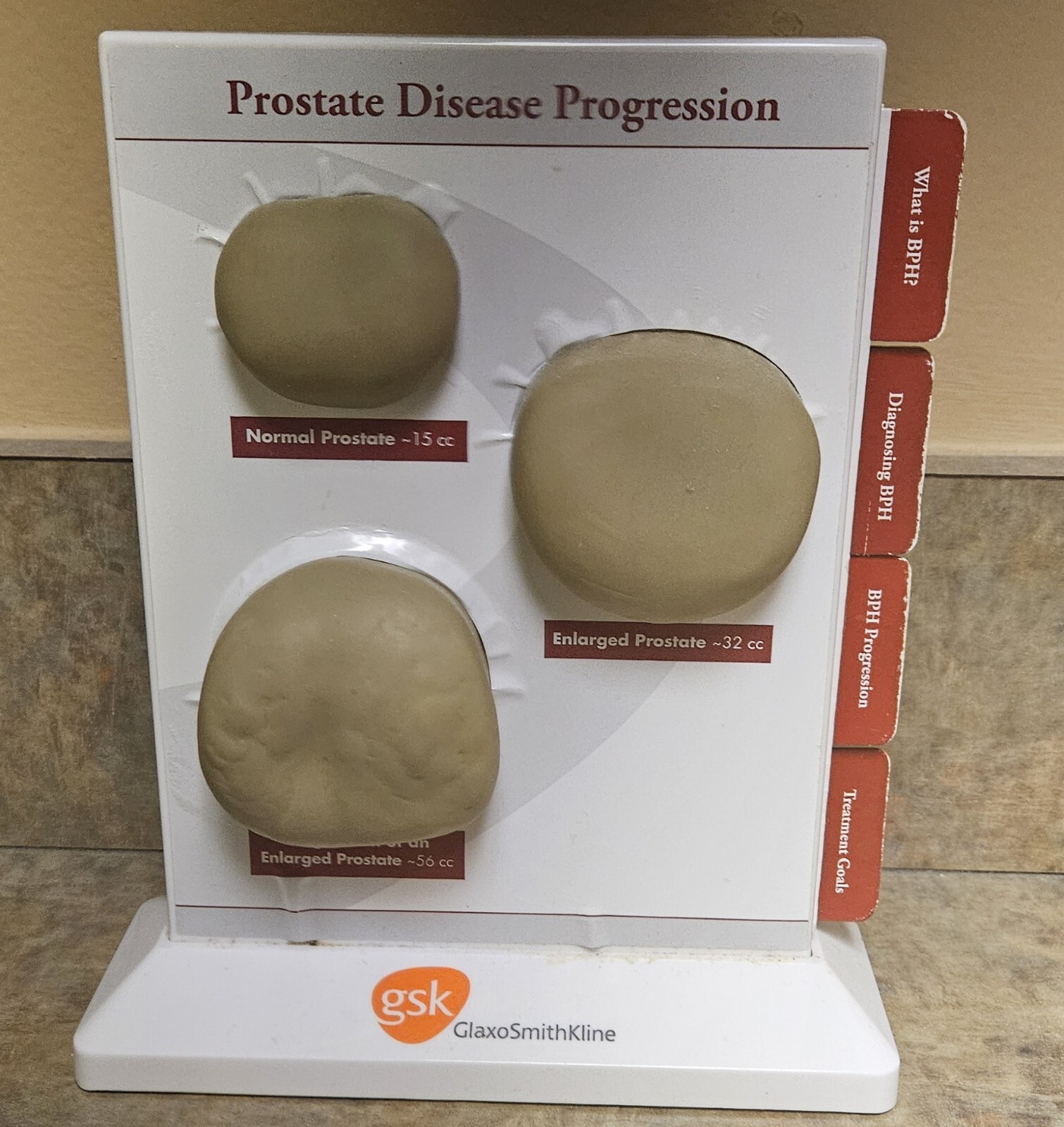 Glaxosmithkline Prostate advertising doctors office display cancer ...