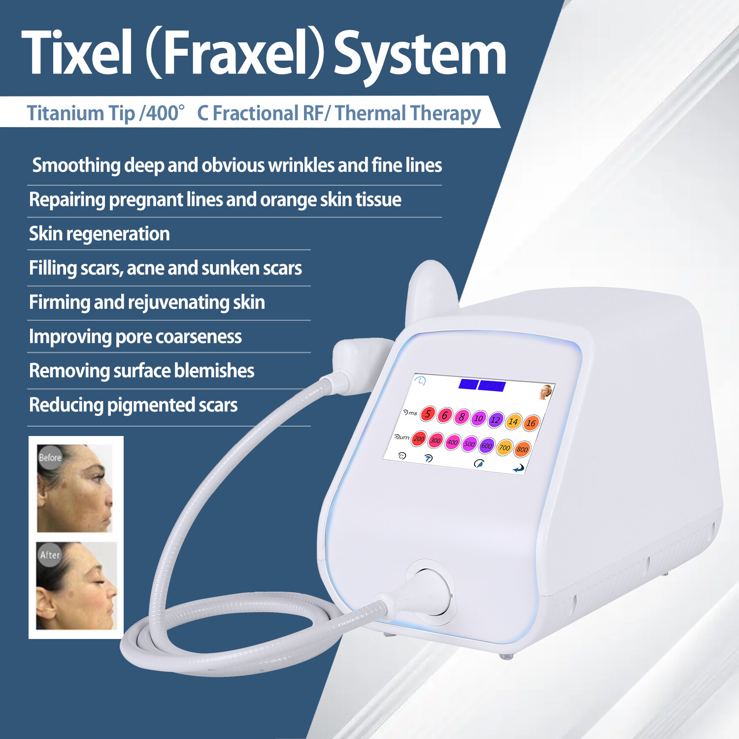 Thermal 400 Fractional Tixel Wrinkle Skin Rejuvenation Machine Anti ...