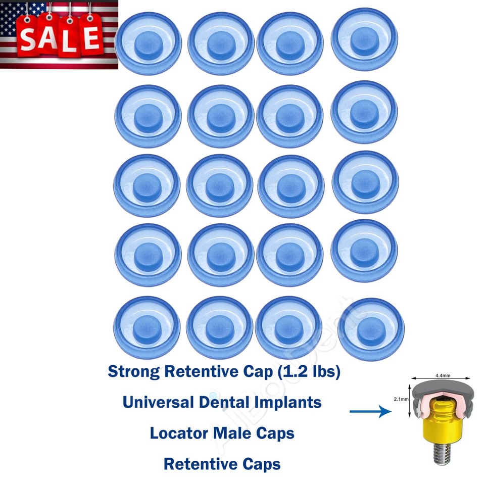 US 4/8/20Pcs Dental Overdenture Retention Implant Caps 1.2Lbs Blue fits ...