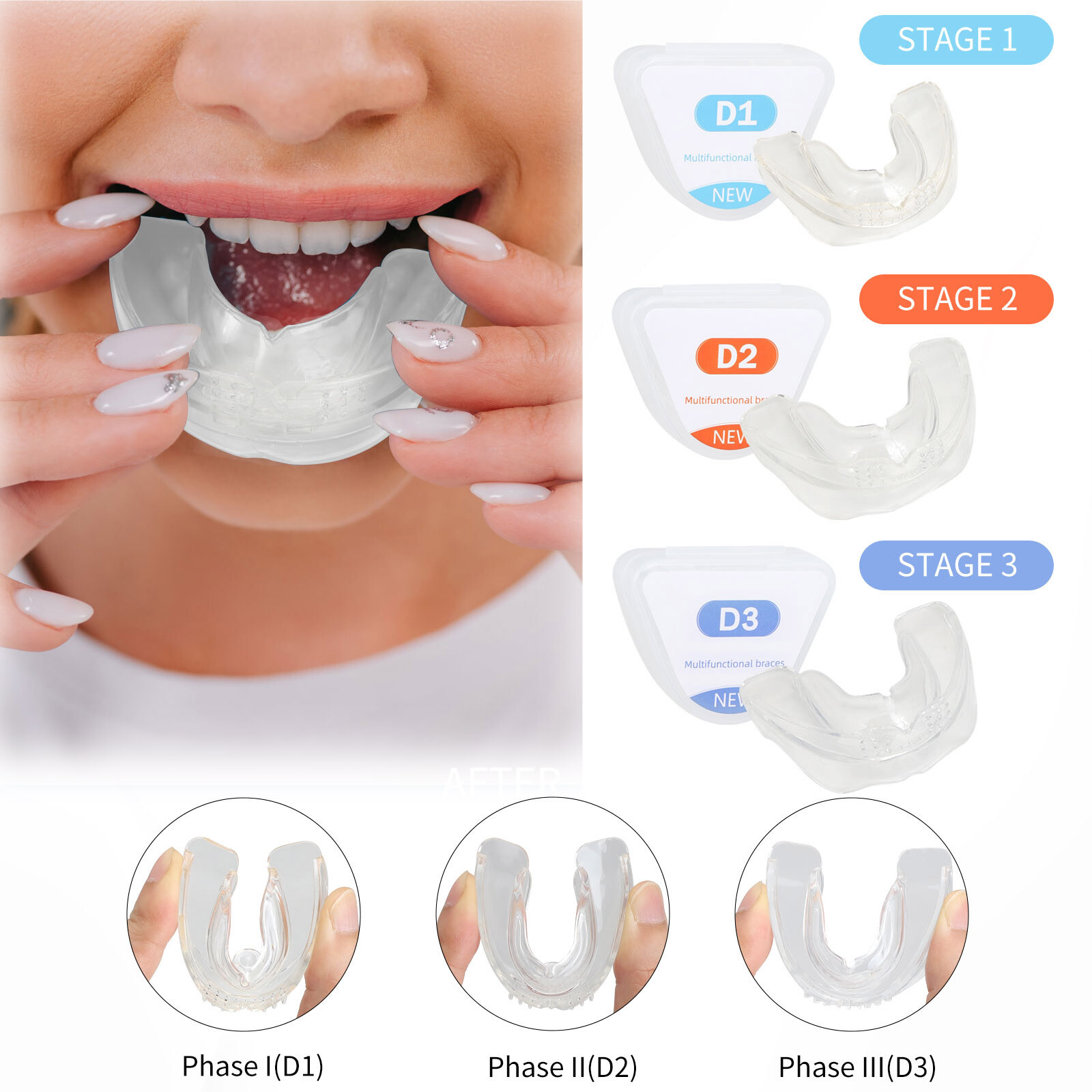 Invisible Dental Orthodontic Braces Teeth Corrector Alignment Trainer ...