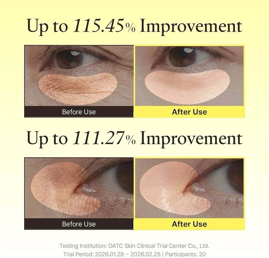 Theralogic Retinal Eye Cream with HPR & Madecell Complex Korean ...