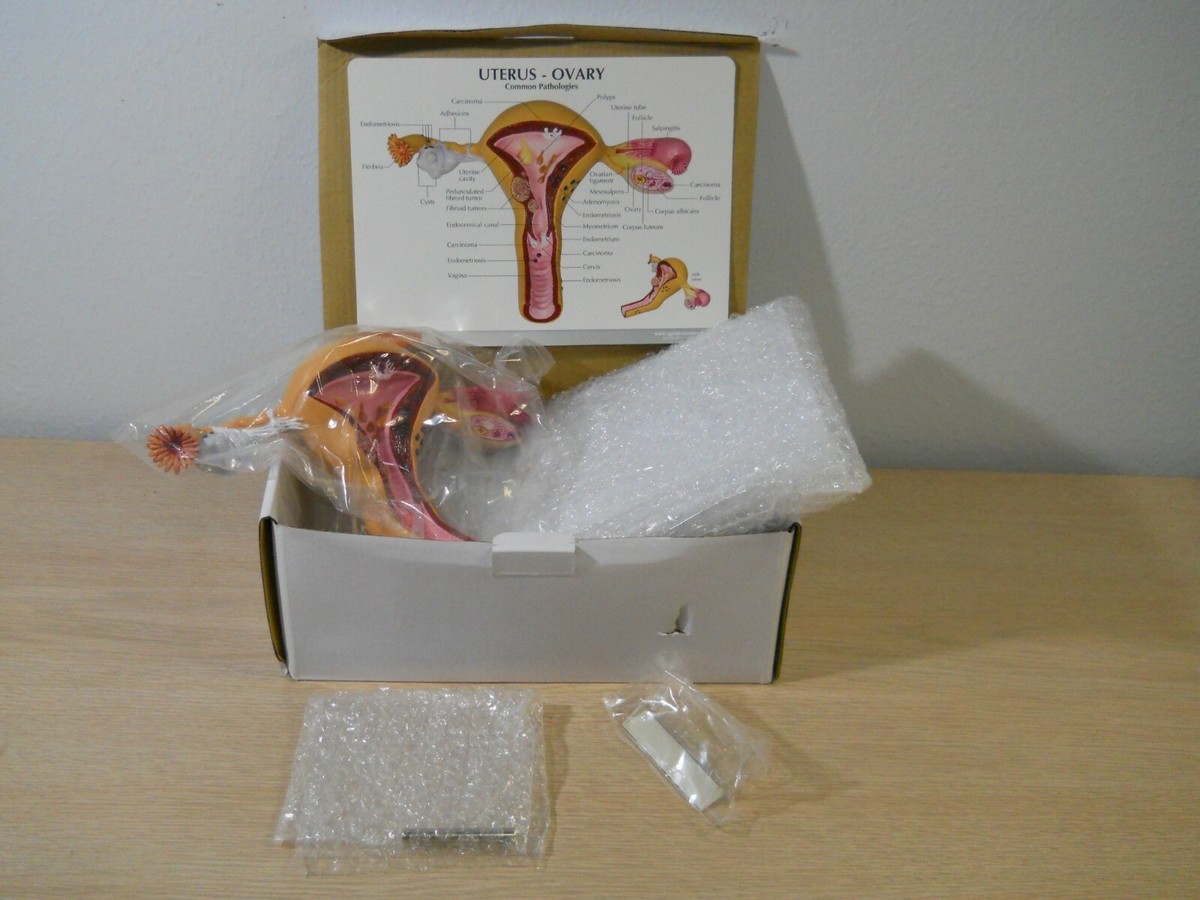 Uterus And Ovary Anatomy Model With Pathologies Ebay Anatomical