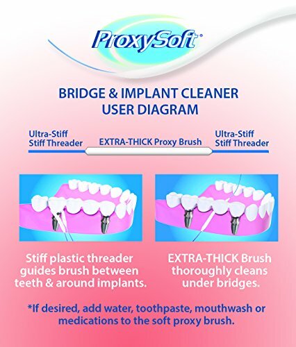 Daily Dental Bridge & Implant Cleaning Threader Floss by Proxy-Soft (30 ...