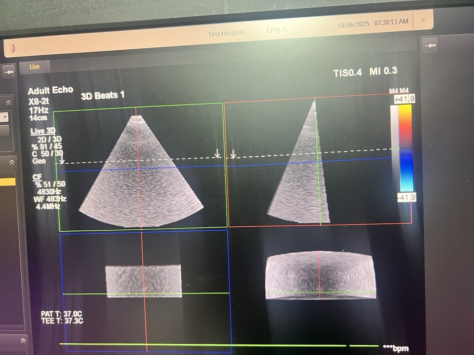 Philips X8-2t Transducer xMatrix TEE Transducer For EPIQ 5 & 7 | eBay