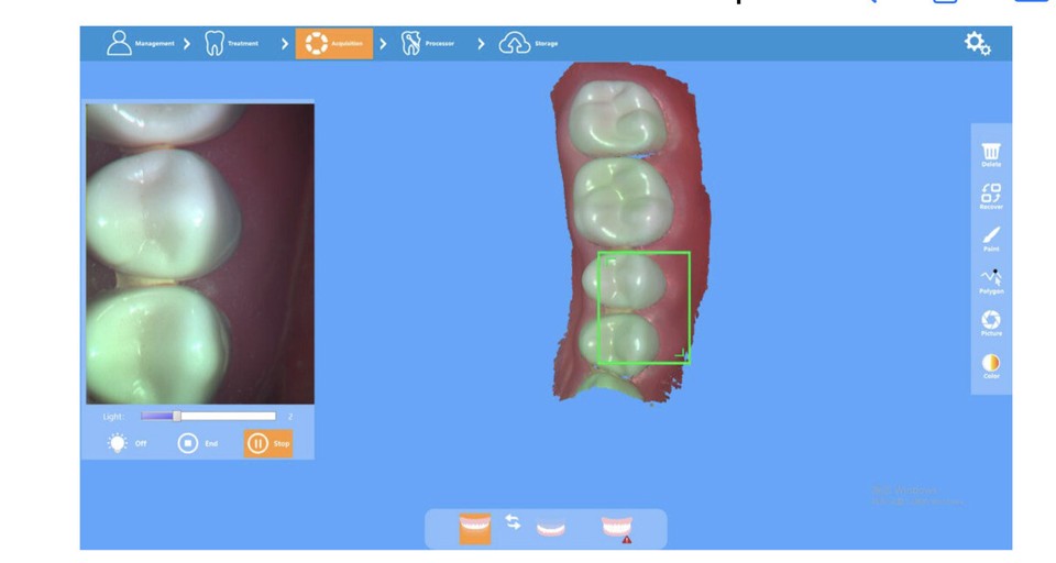 dental 3d scanner #Intraoral Scanner Impression Sinus | eBay