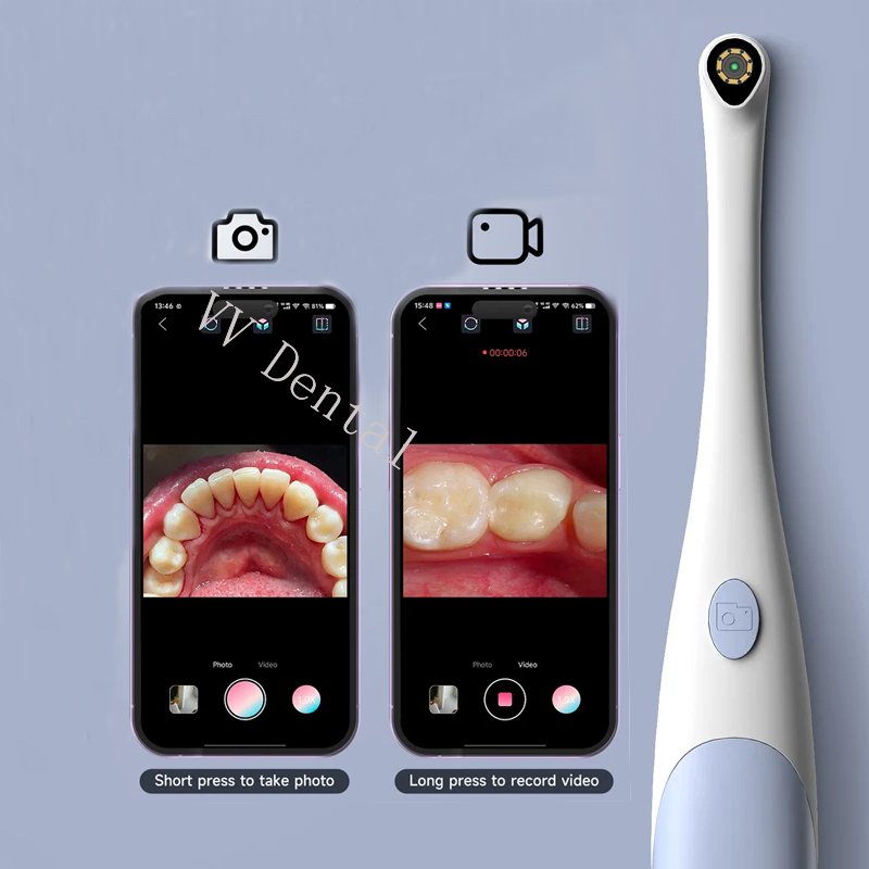 Dental USB Intraoral Camera Wireless Oral Endoscope LED 480P/1440P ...