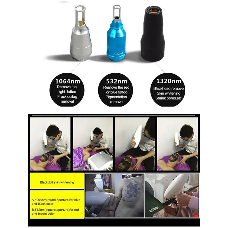 Nd YAG Picosecond Laser Tattoo Removal Machine Pigment Pico Skin ...