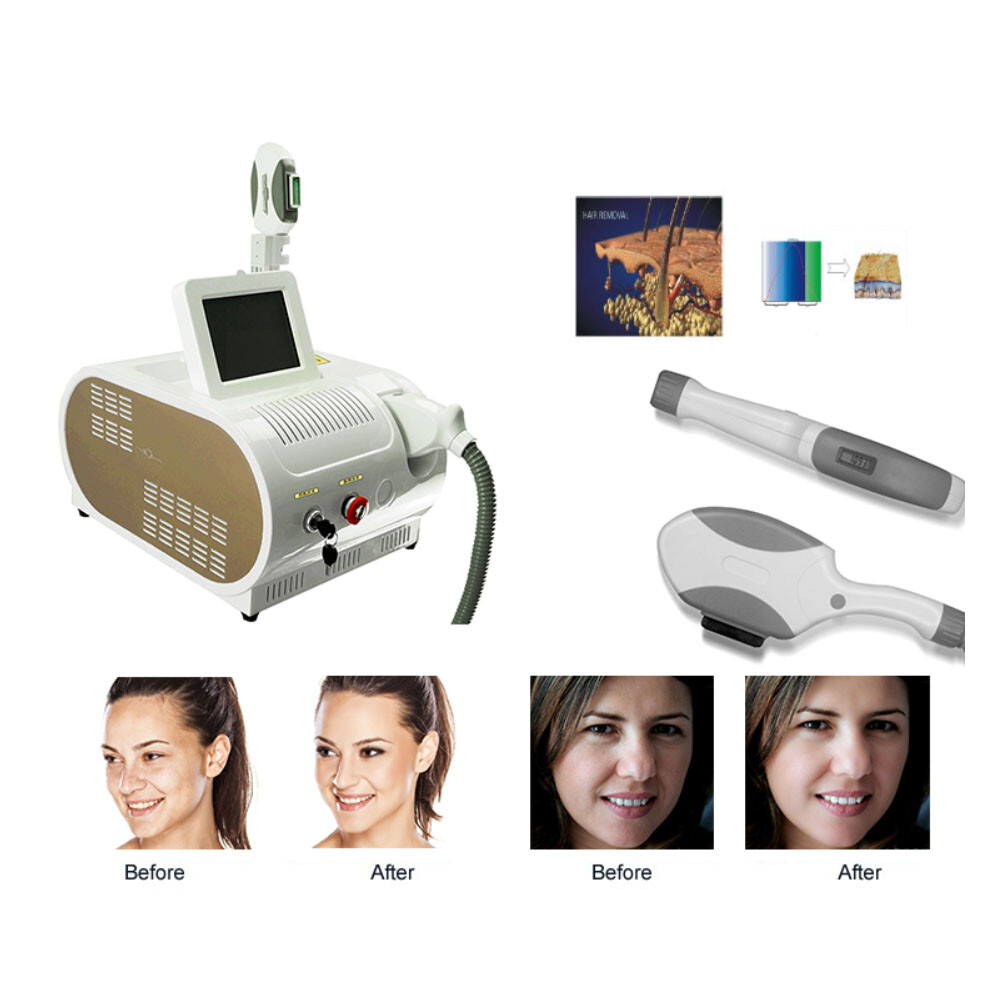 PRO IPL Elight OPT Laser Permanent Hair Removal RF Skin Care Salon ...
