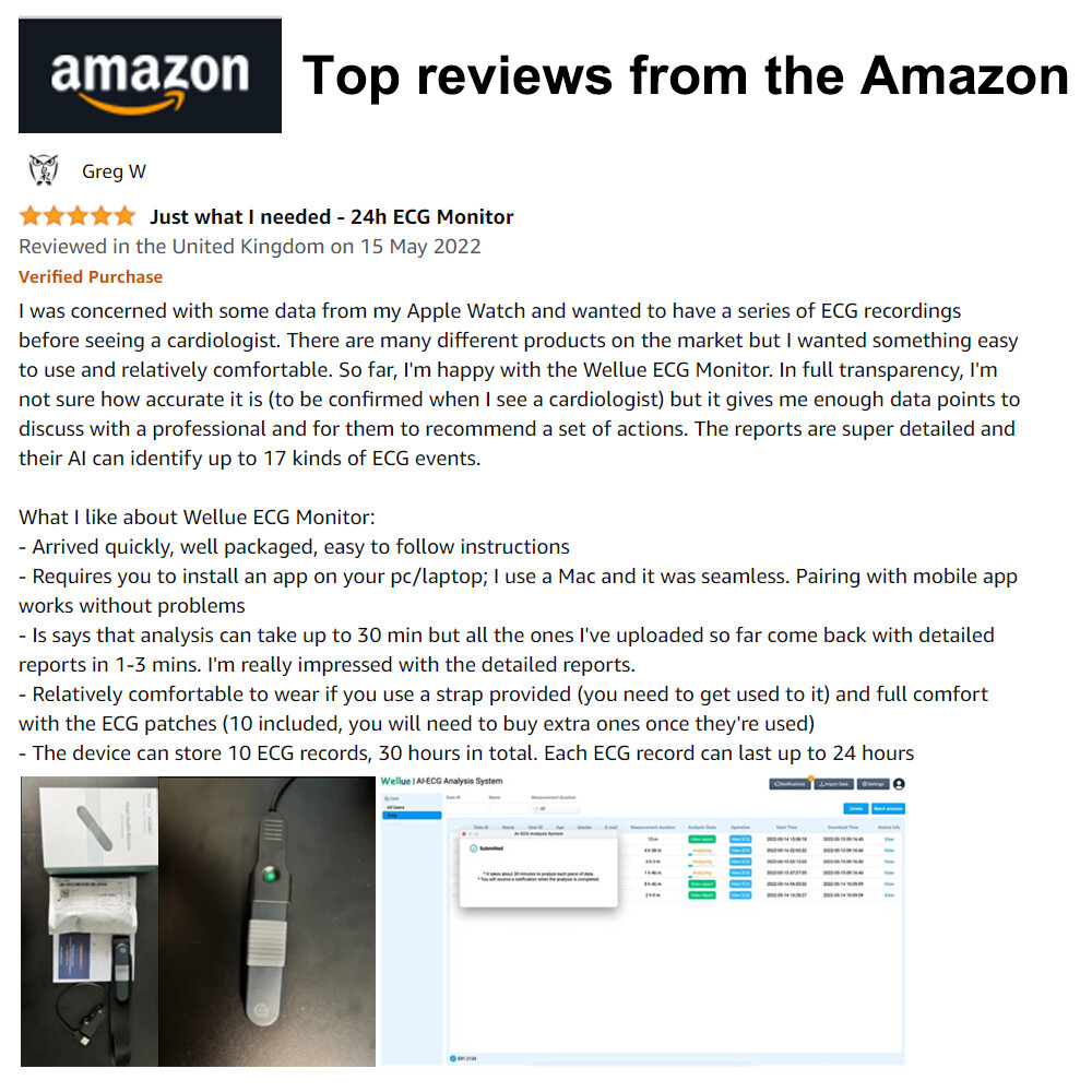 AI Holter Monitor 24 Hrs Chest Strap EKG Monitor with Free AI Analysis ...