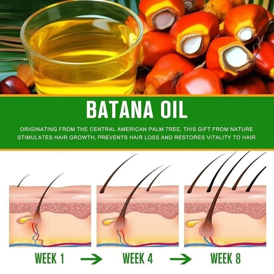 Organic Batana Oil - Hair Growth Oil, Botana Oil, Sourced from Honduras ...