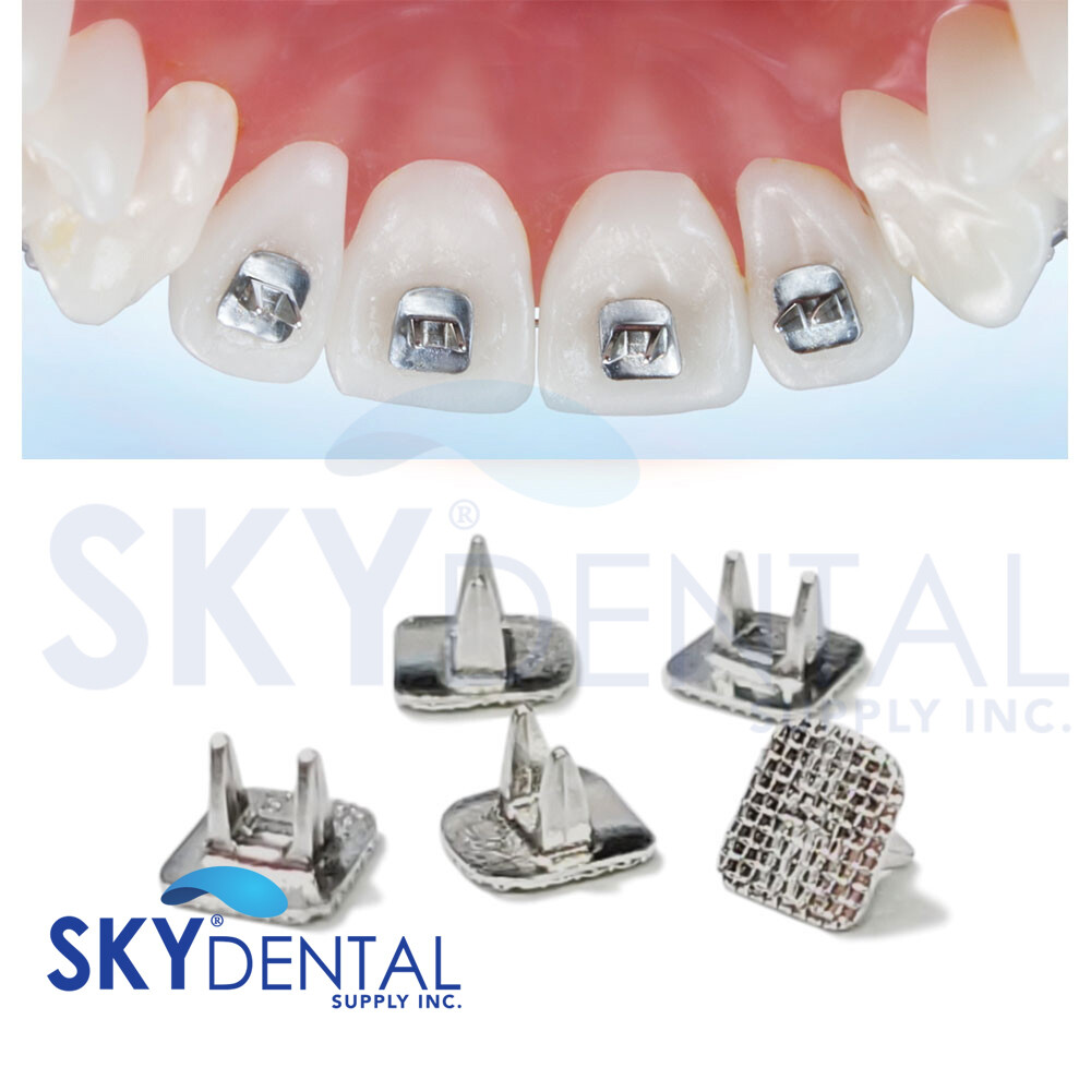 Tongue Tamers Dental Bondable Hinge Orthodontic Bite Turbos Opener ...