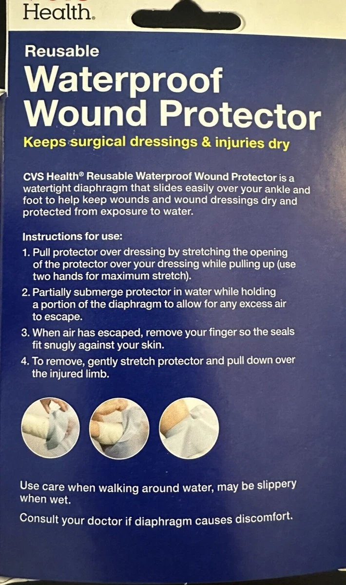 Finger Cast Cvs
