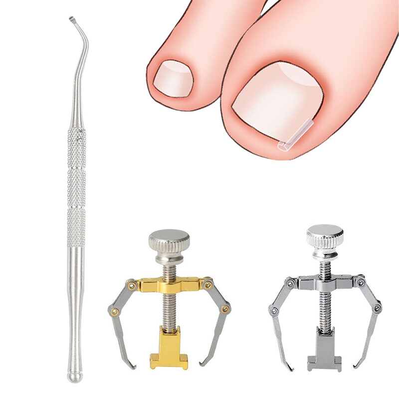 Ingrown Toe Nail Correction Lifter Tool Fixer Toenail Straightener ...