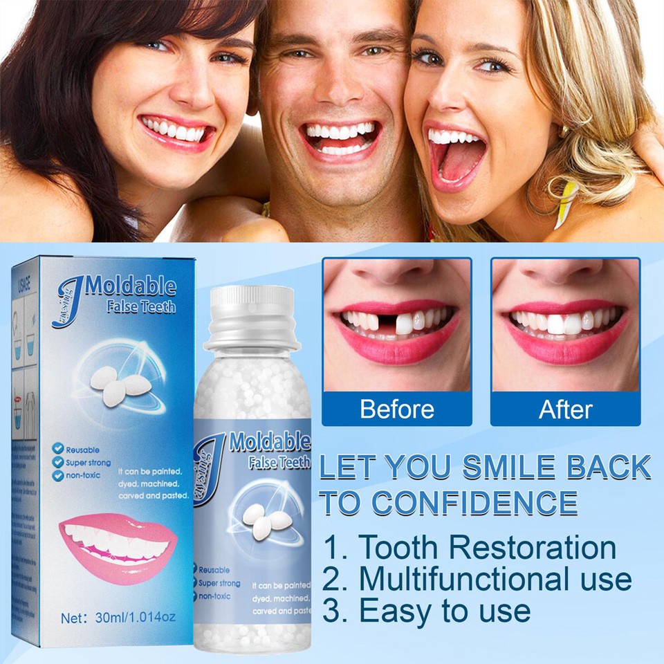 Tooth Repair Beads Granules Temporary Tooth Glue Reusable Moldable ...