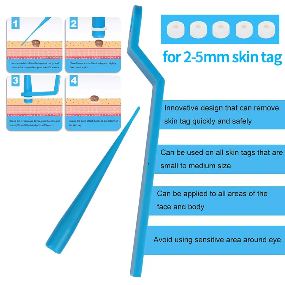 Rubber Bands Skin Tag Remover Skin Tag Removal Kit Mole Wart Tool Face ...