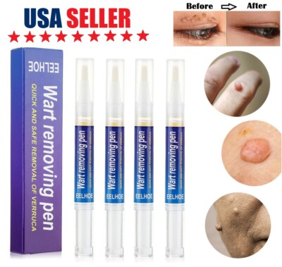 4× Wart Remover Pen Eliminate Skin Tag Foot Corn Mole Warts Restoration ...